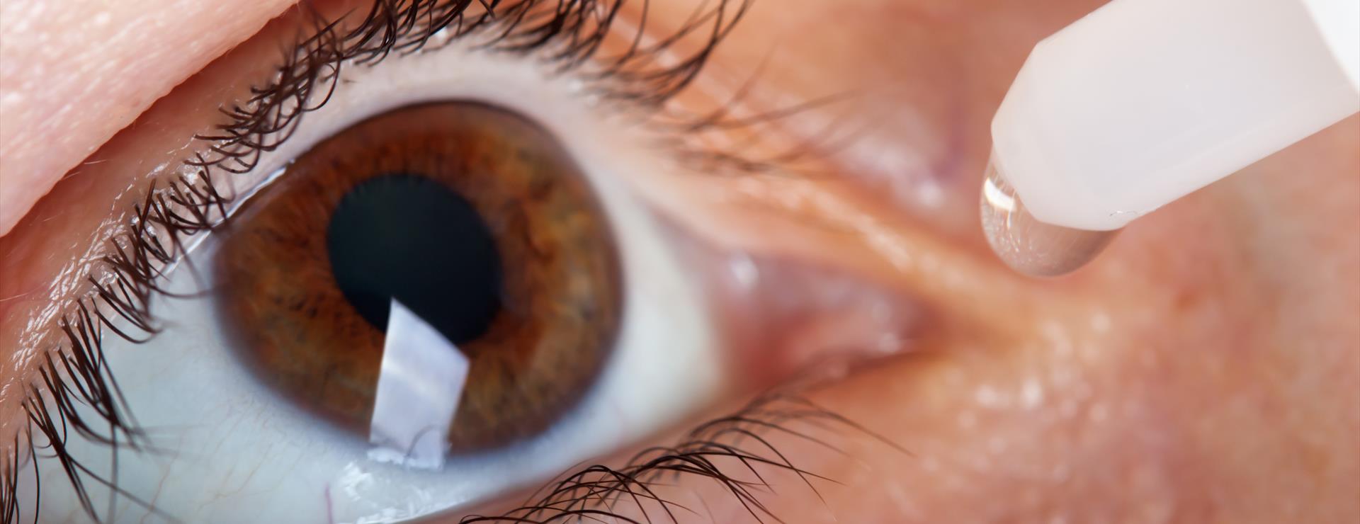 Ogen laseren? Veilig ooglaseren bij Eyescan Ooglaserkliniek